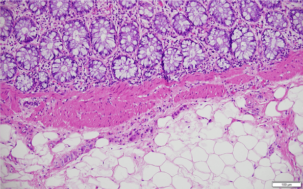 H&E Staining on Colon