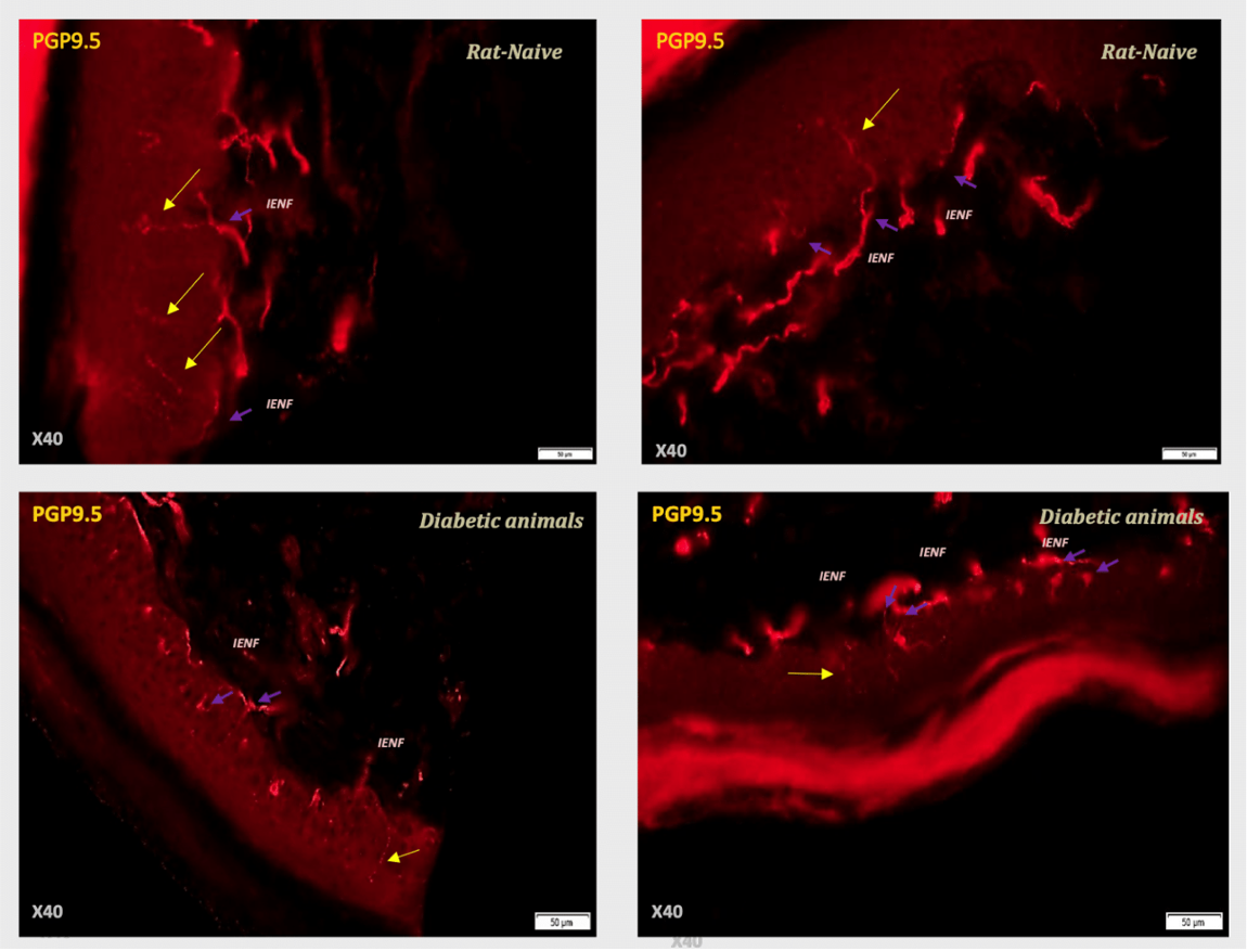 IENF Analysis of plantar skin
