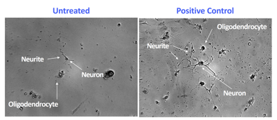 Spinal Cord Injury (SCI) Models