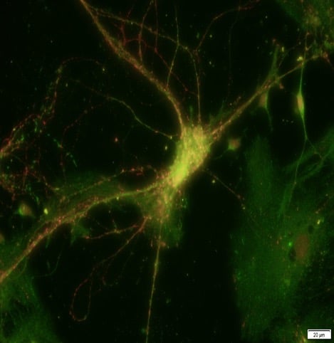 Synaptic Imaging Assay