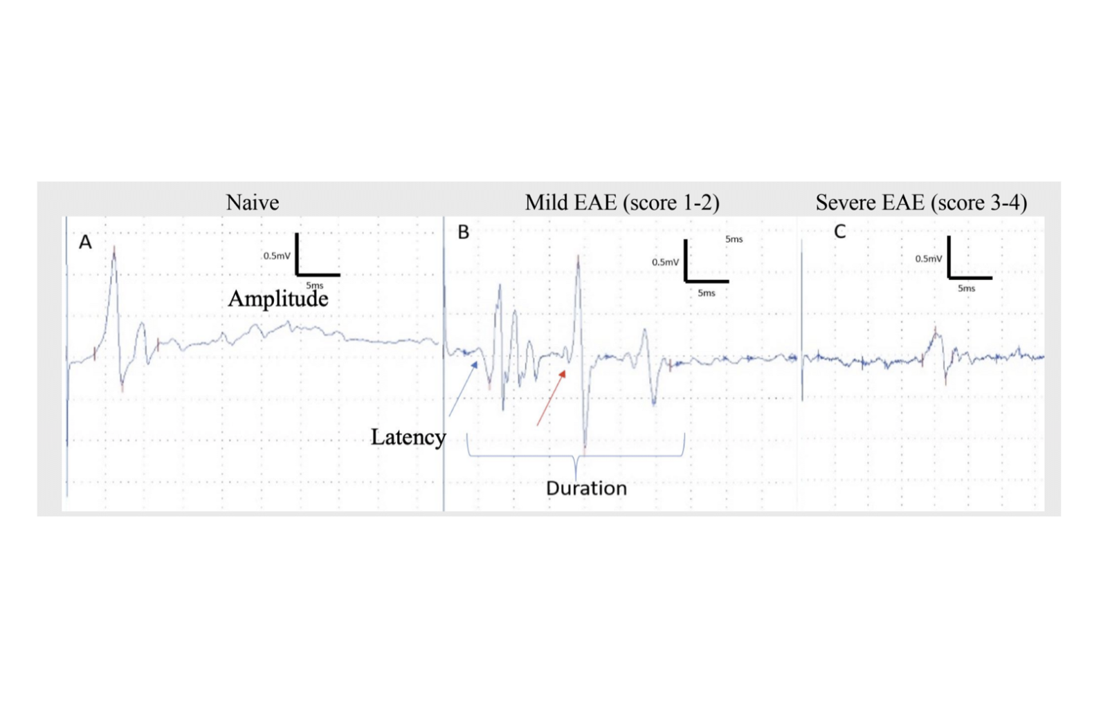 EAE Multiple Sclerosis Research