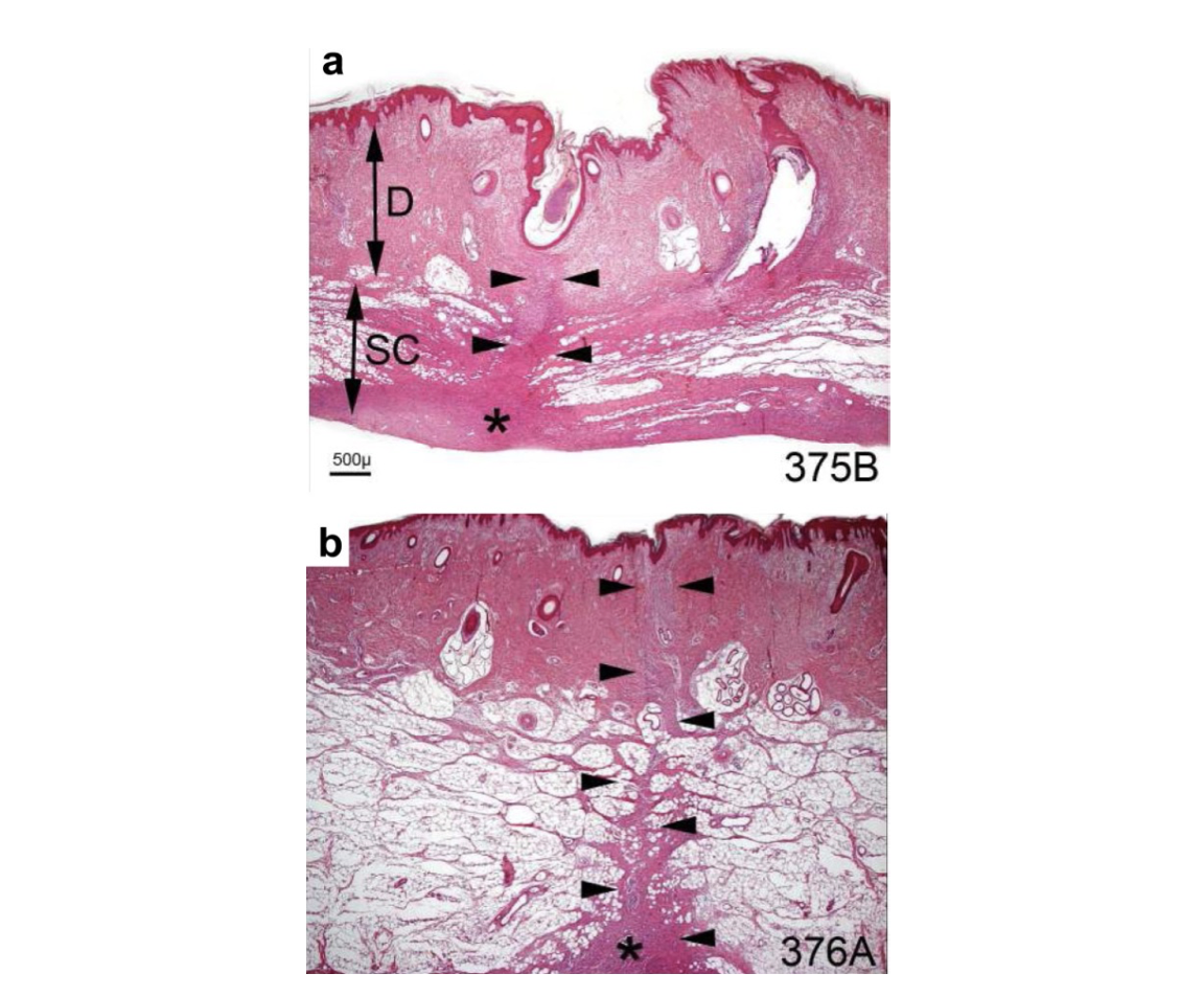 Pig Models | Skin Wound Healing Research