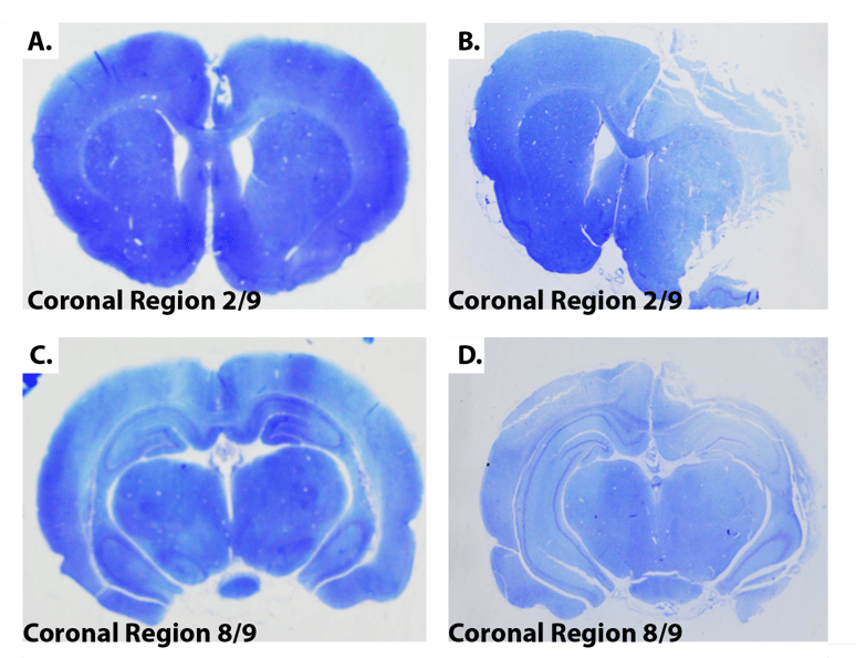 Preclinical Stroke/Cerebral Ischemic Research Models