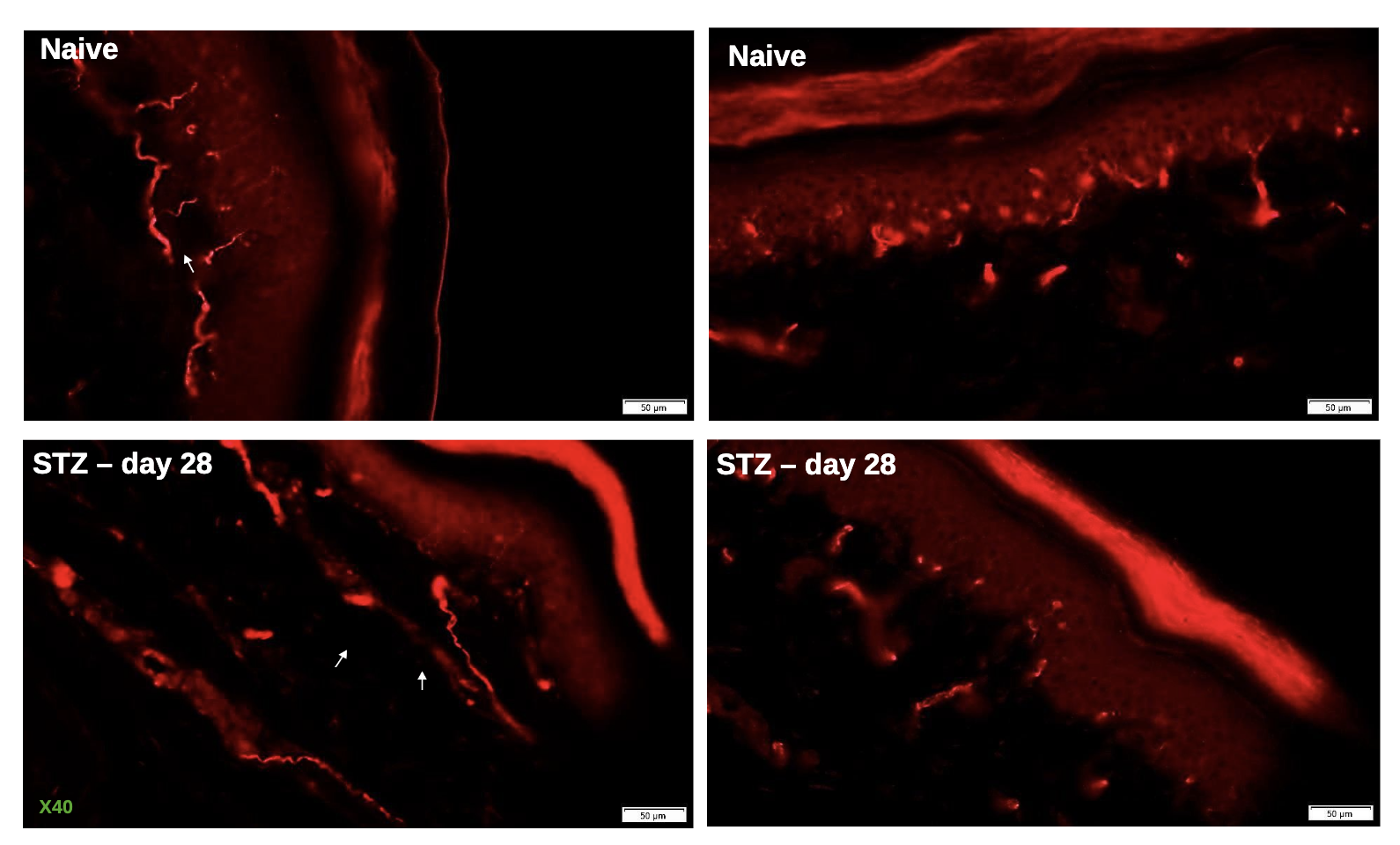 STZ-induced Diabetic Neuropathic Pain Model