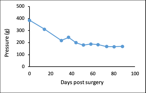 Neuropathic Pain | Spinal Nerve Ligation (SNL) Model