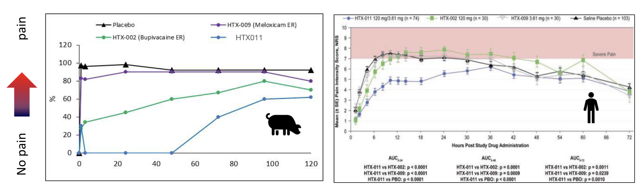 Three ways to approach translation