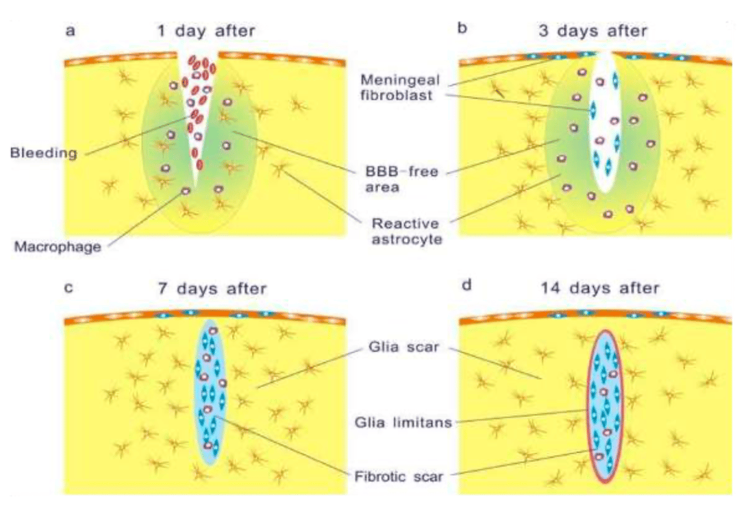 Spinal Cord Injury and The Importance of Diversity in Modeling