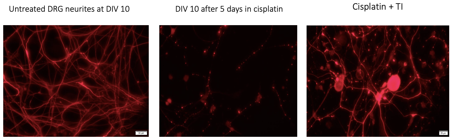 Preclinical Efficacy Models of Chemotherapy-Induced Peripheral Neuropathy