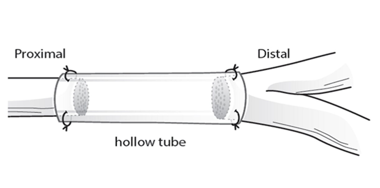 The Development of Peripheral Nerve Repair Models