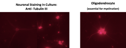 Neurite Outgrowth In Vitro Assay