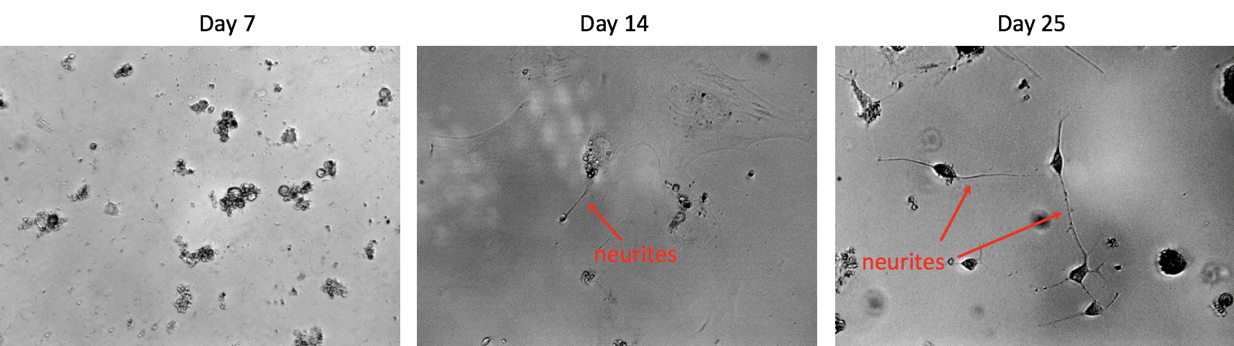 Neurite Outgrowth In Vitro Assay